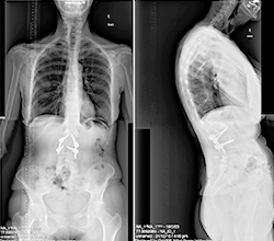 Shimadzu Medical Systems - Canon X03 Pro Detectors