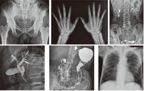 Shimadzu Medical Systems - Sonialvision G4